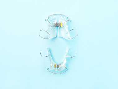 Retenedores removibles: Qué son y por que los necesitas - DR SMILE X ...